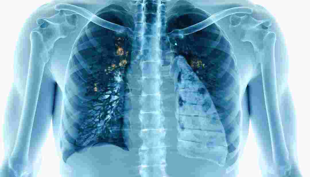 Transpyloric Plane: Anatomy and Clinical Importance